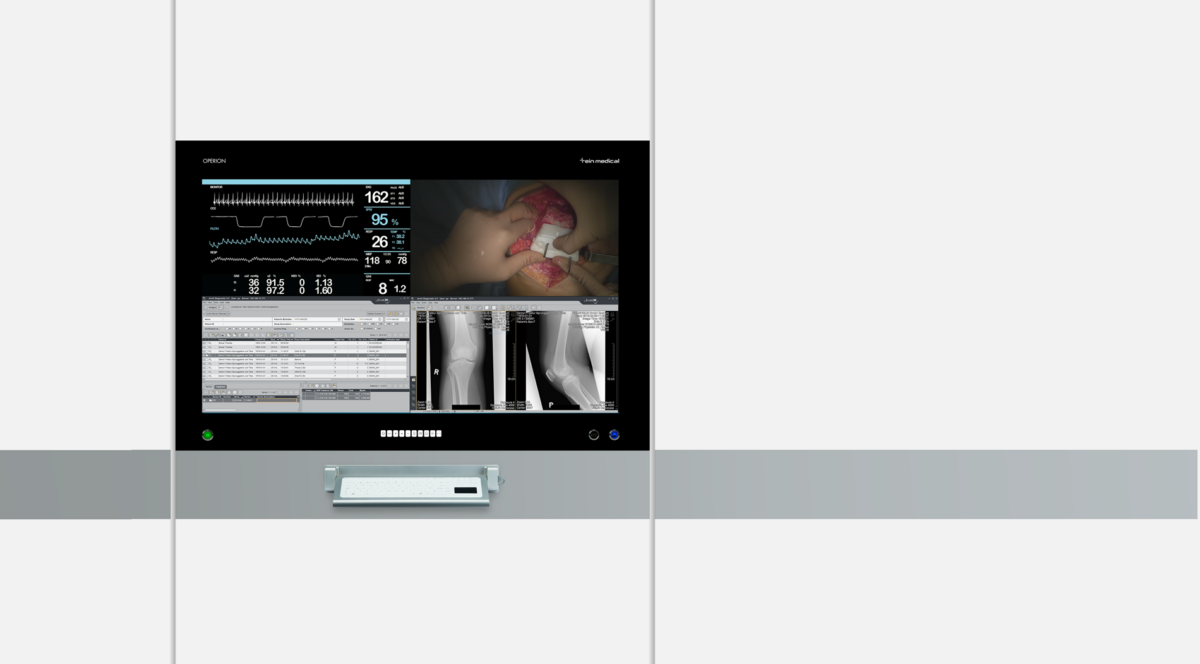 OPERION - Rein Medical