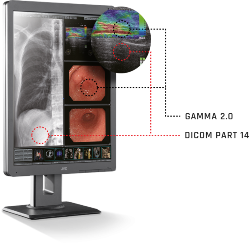 JVC Displays - Findings monitor - Rein Medical